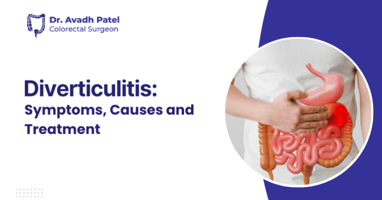Diverticulitis: Symptoms, Causes and Treatment - Dr Avadh Patel