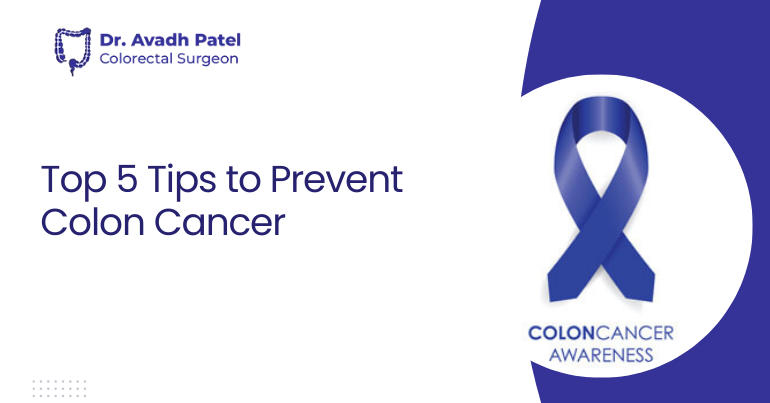 Top 5 Tips to Prevent Colon Cancer | Dr. Avadh Patel